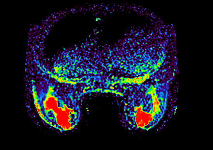 DWI Processing | IB Diffusion