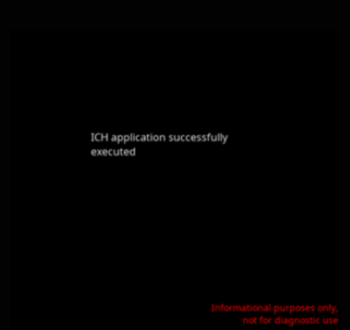 ICH Detection and Prioritization | CINA Head - ICH